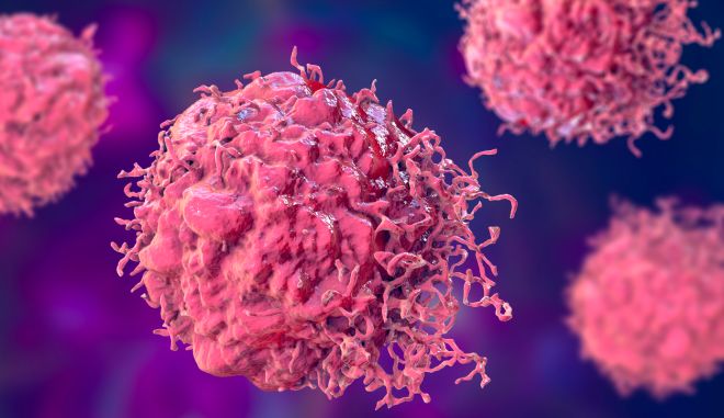 Τι είναι το Καρκίνωμα nut: Η σπάνια νόσος με την οποία πάλεψε γενναία ο ...